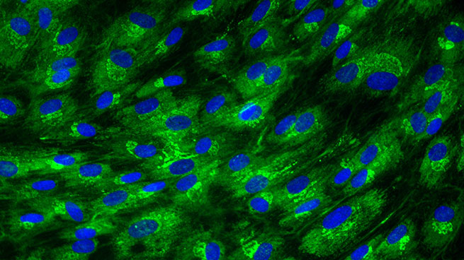 Wound healing, granulation phase and maturation phase - Bioalternatives