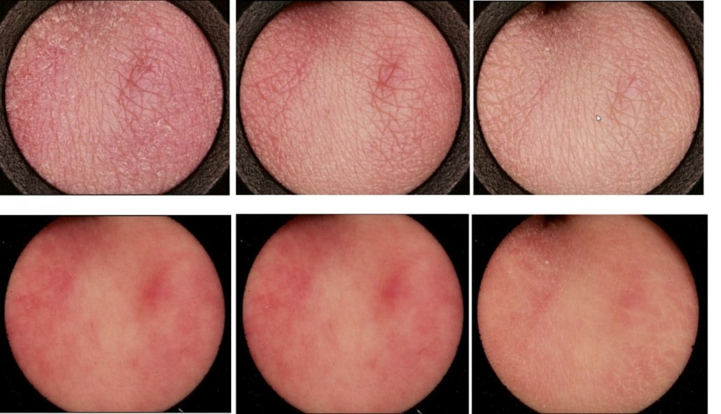 Hydration and skin barrier - Cosmetic efficacy studies, in vitro tests