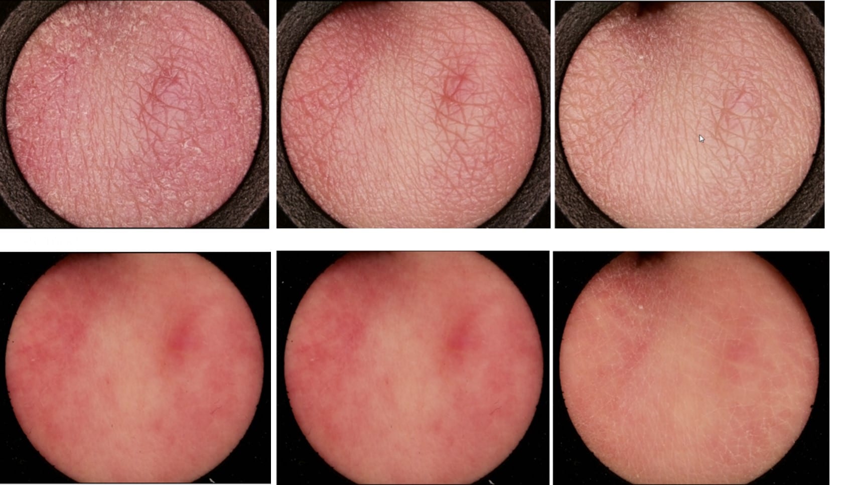 Hydration and skin barrier - Cosmetic efficacy studies, in vitro tests