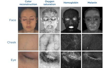 SpectraCam & SpectraFace - Study invisible parameters of the skin ...