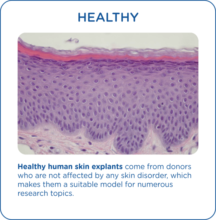 Human skin explant - QIMA Life Sciences