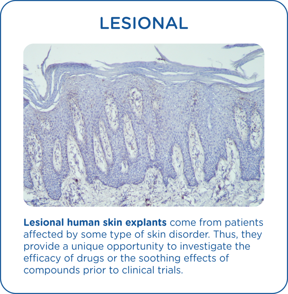 Human skin explant - QIMA Life Sciences