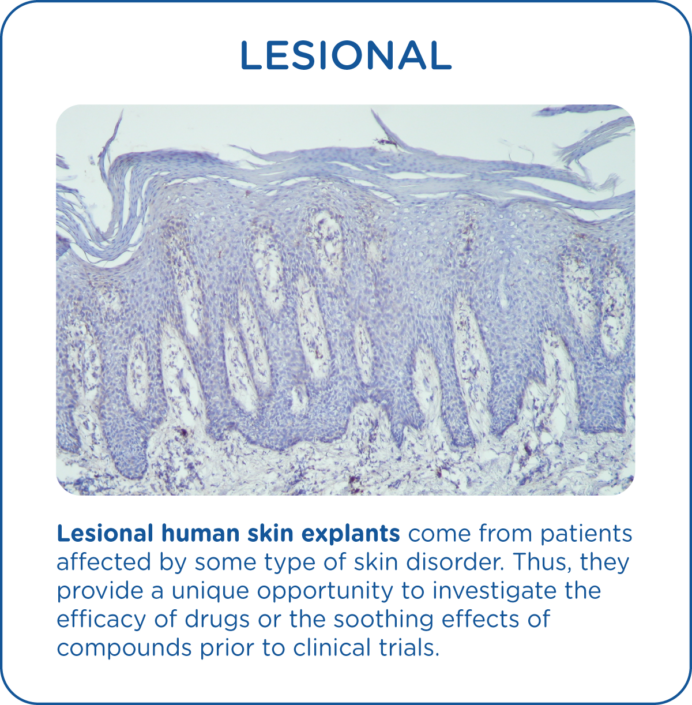 Human skin explant - QIMA Life Sciences