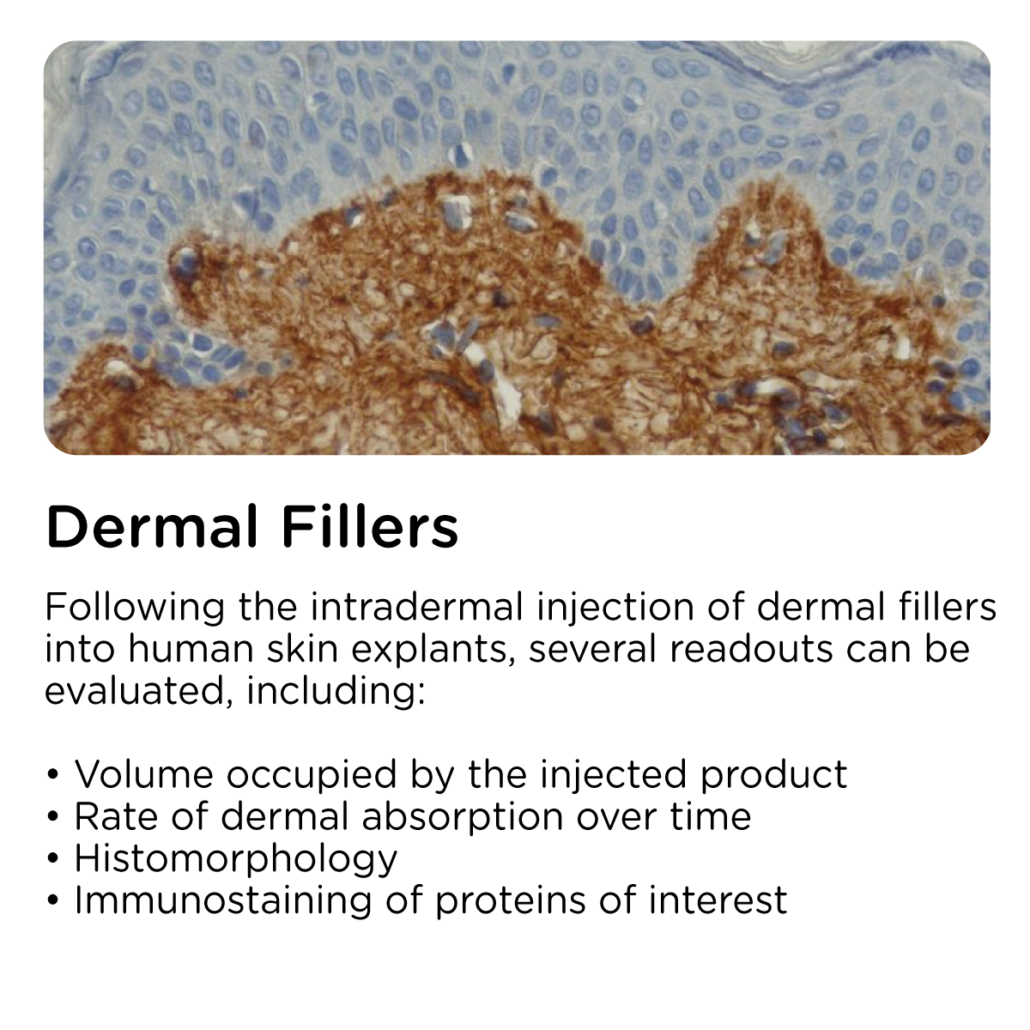 Human skin explant - QIMA Life Sciences