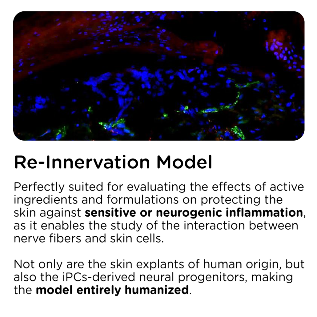 Human skin explant - QIMA Life Sciences