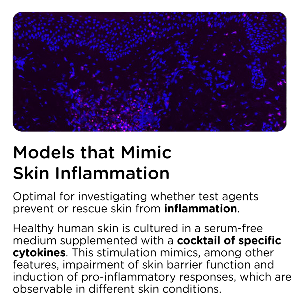 Human skin explant - QIMA Life Sciences