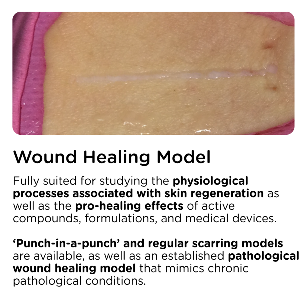 Human skin explant - QIMA Life Sciences