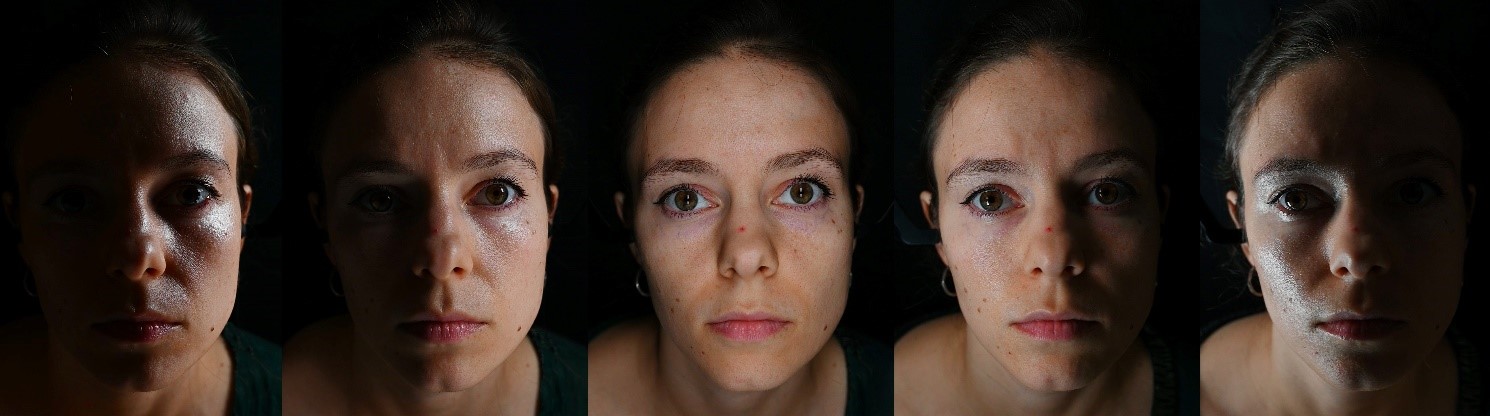 DynaCam® : our all-in-one full face imaging system