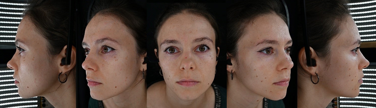 DynaCam® : our all-in-one full face imaging system