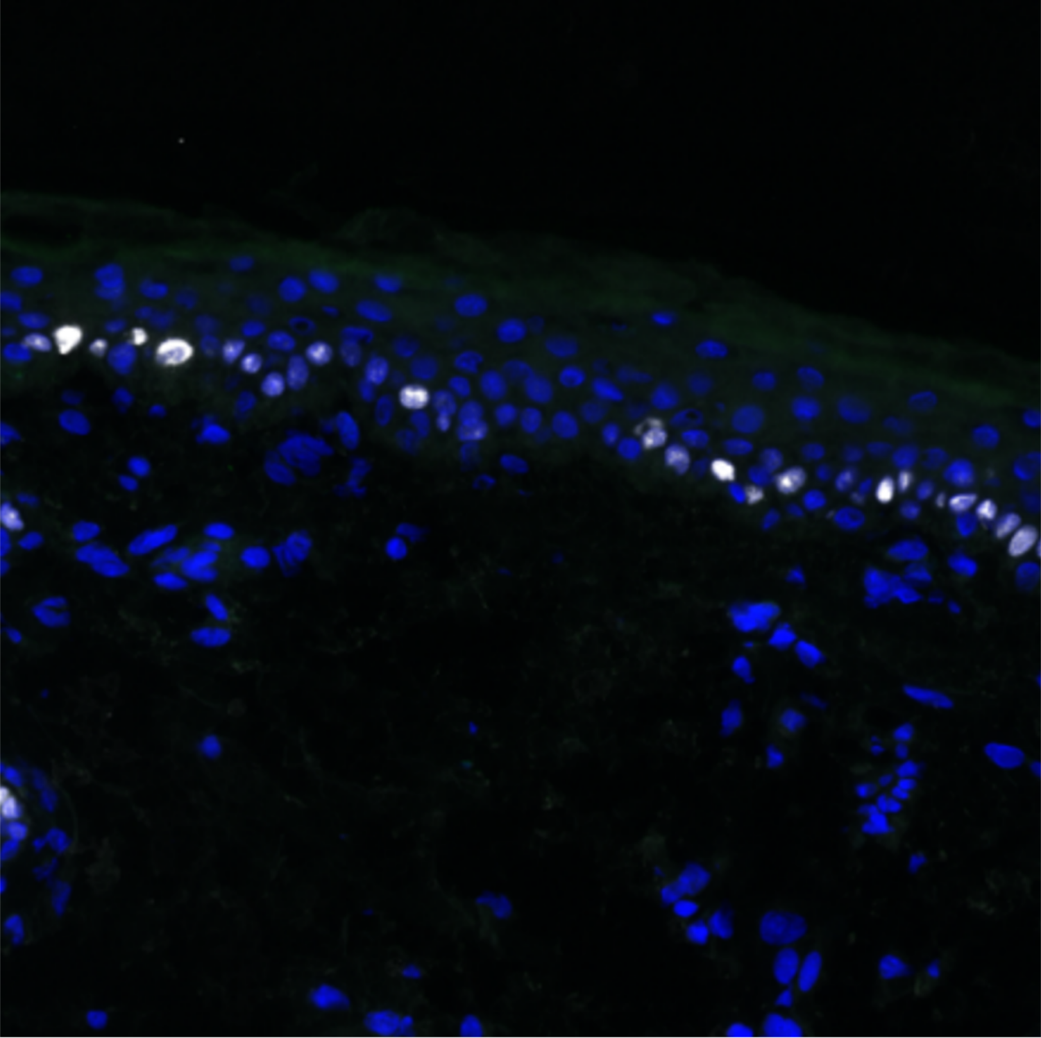 Ex vivo human skin mimicking intrinsic aging | QIMA Life Sciences