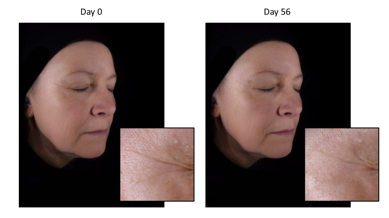 Digital imaging analysis enhances clinical evaluation of skin aging