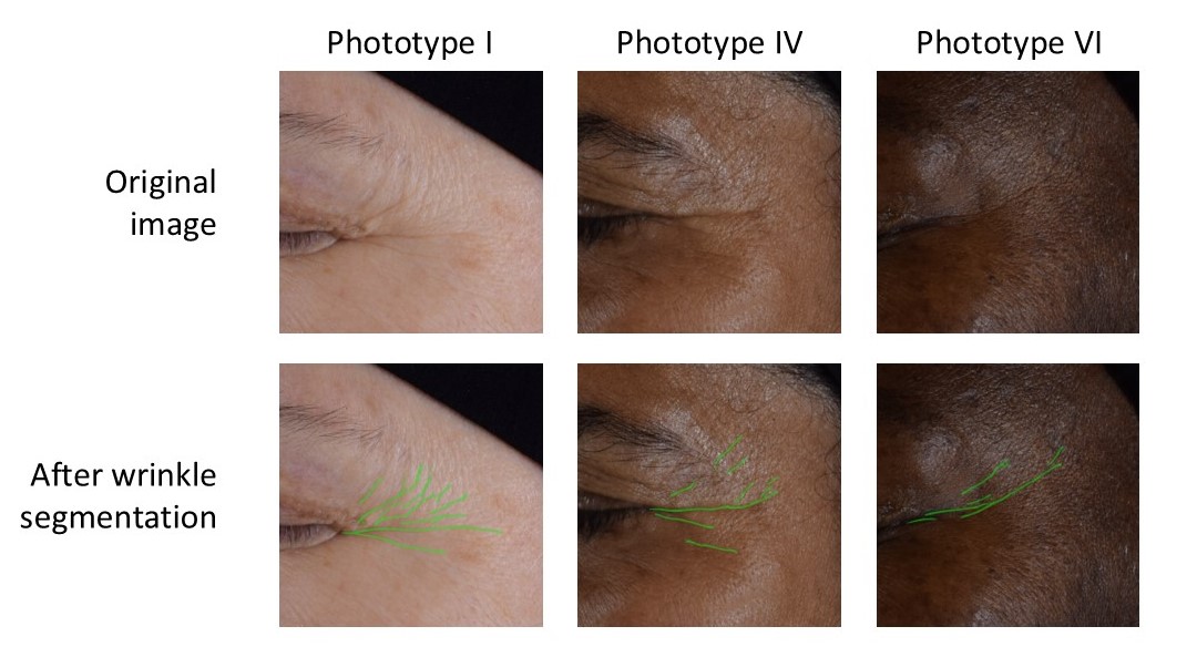 Digital imaging analysis enhances clinical evaluation of skin aging
