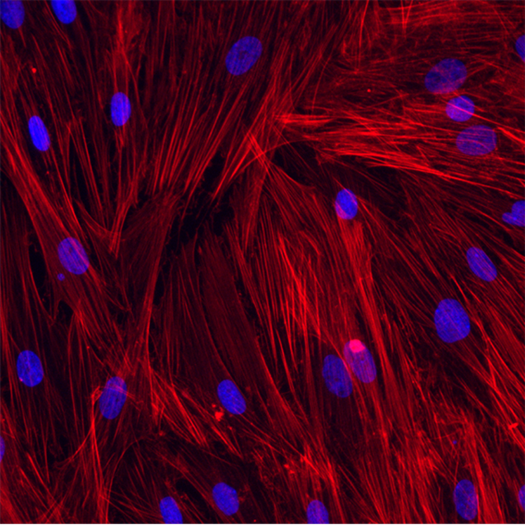Fibroblast senescence model for aging studies | QIMA Life Sciences