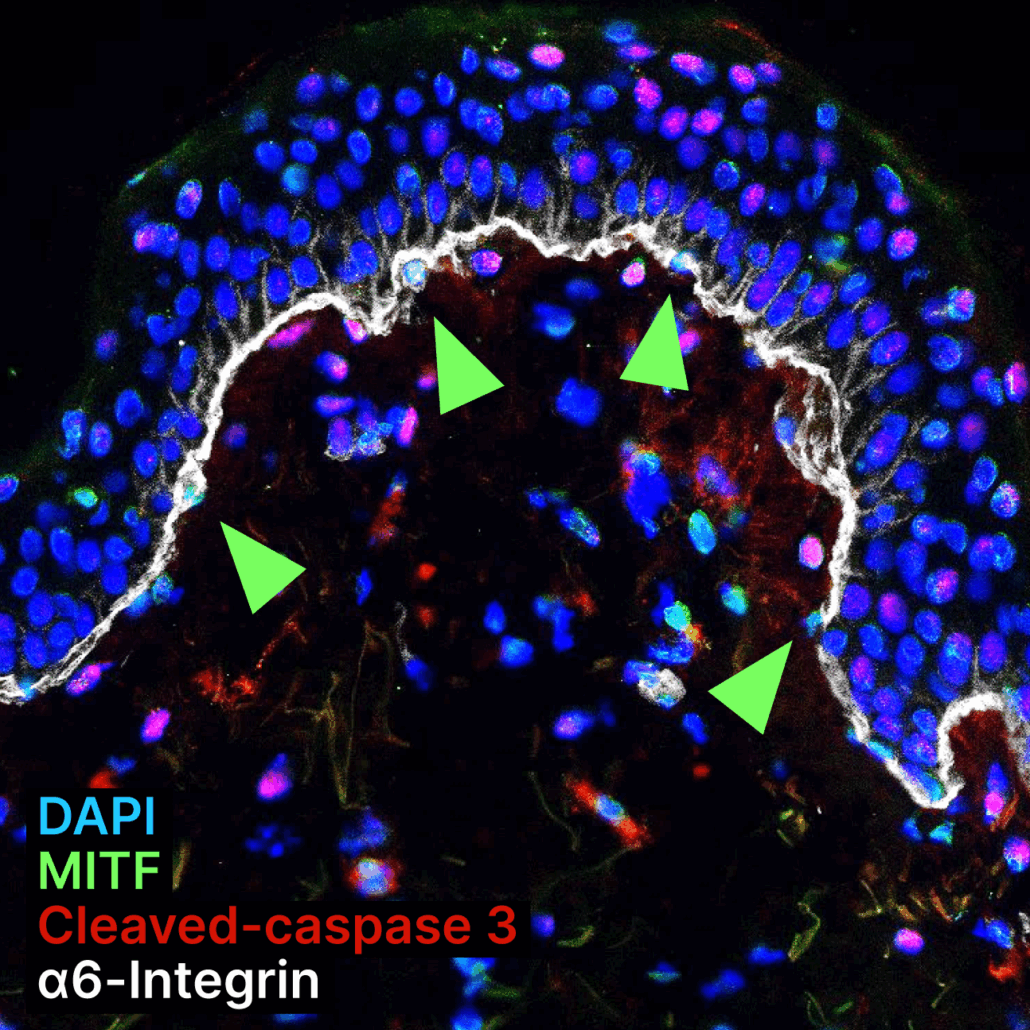 Vitiligo-induced ex vivo model | QIMA Life Sciences