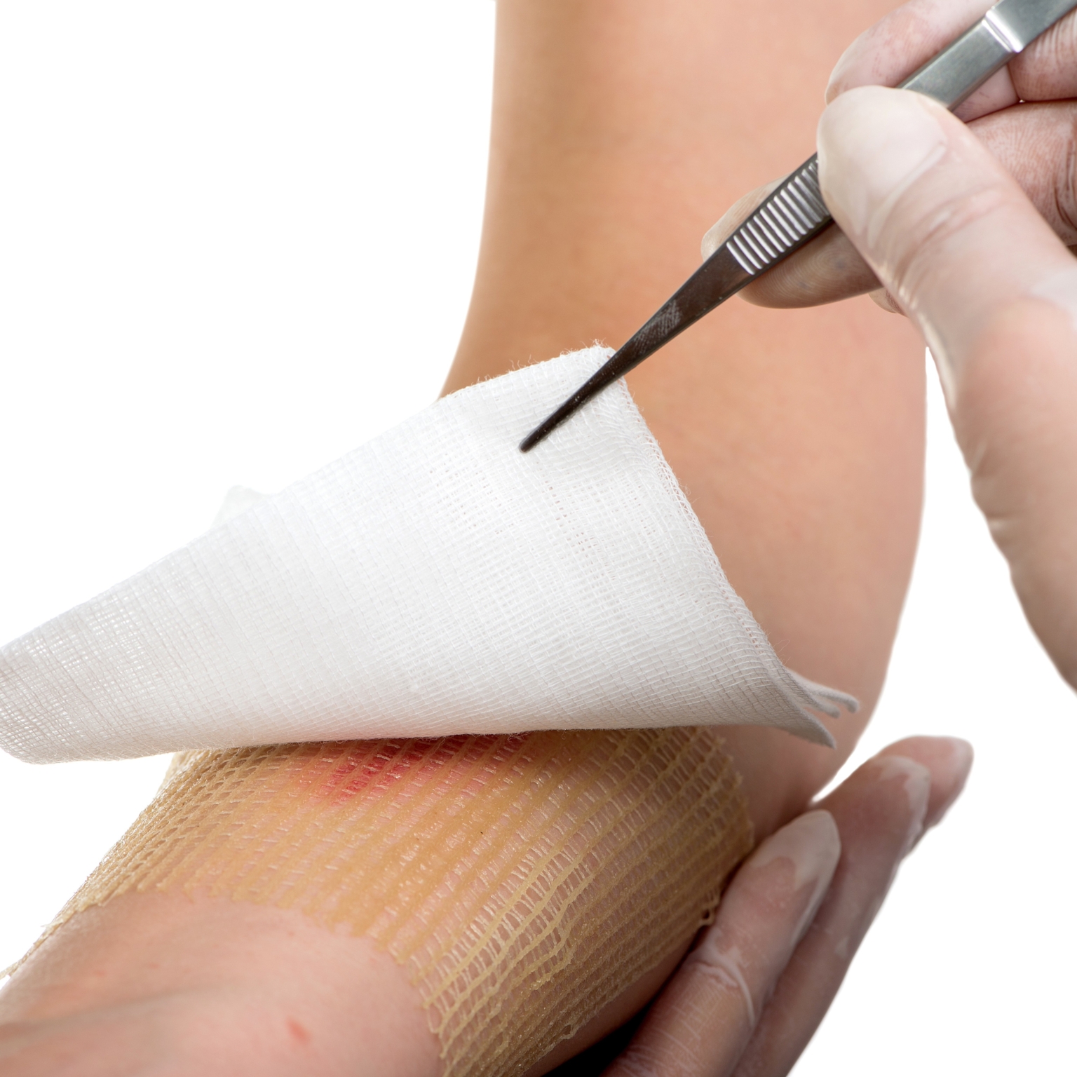 Acute and Chronic Wounds | QIMA Life Sciences