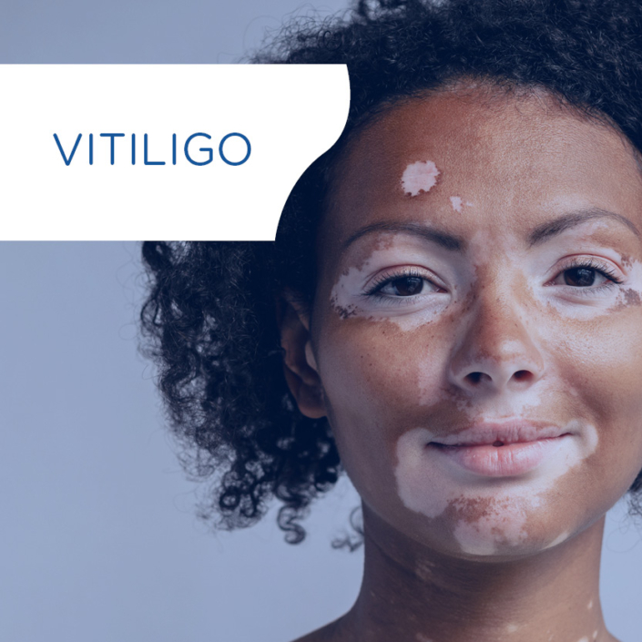 In Vitro Pharmacology - Drug Discovery & Development